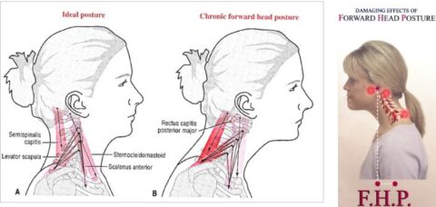 TMJ Disorders | TMJ & Sleep Therapy Centre of New England